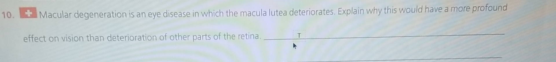 Solved Macular degeneration is an eye disease in which the | Chegg.com