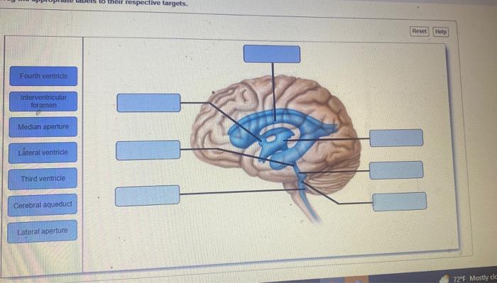 Solved Fourth ventricle Interventricular foramen Median | Chegg.com