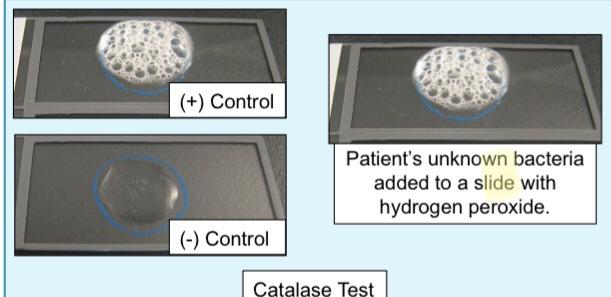 Solved (+) Control Patient's unknown bacteria added to a | Chegg.com