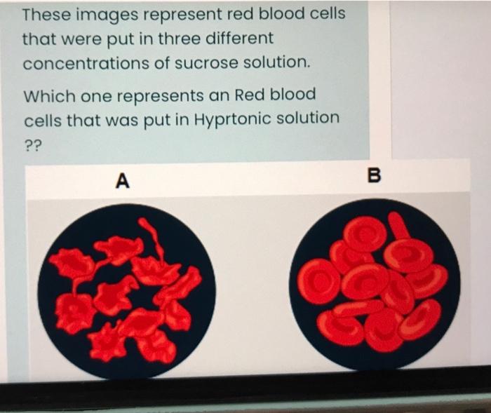 Solved These images represent red blood cells that were put | Chegg.com