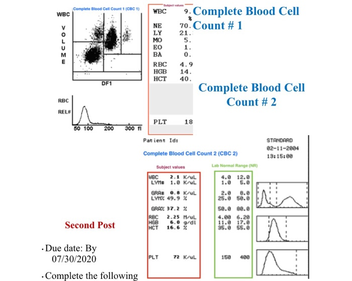 Activity #1 - Analyzing CBCs (Complete Blood Count) | Chegg.com