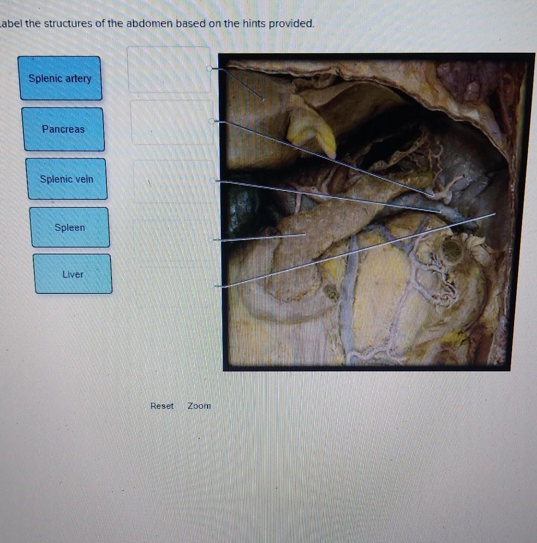 [Solved]: Label the structures of the tho