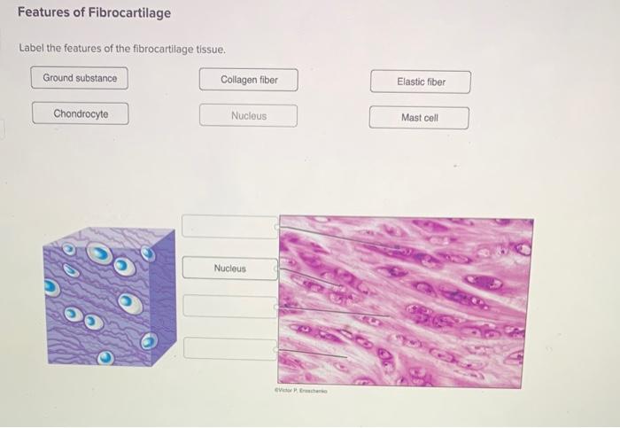 Solved Features of Fibrocartilage Label the features of the | Chegg.com