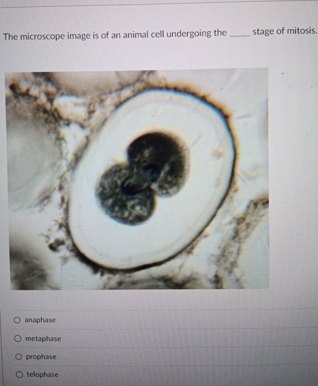 The microscope image is of an animal cell undergoing | Chegg.com