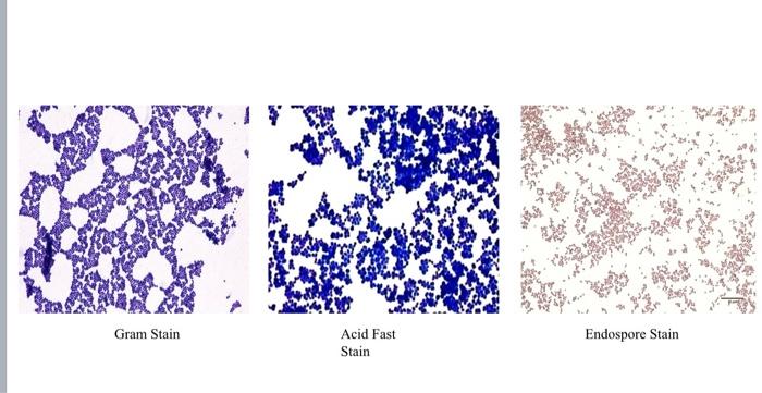 Endospore Stain Damamkar ta lles Proner Mirmhial | Chegg.com