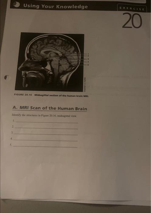 Solved 2. 3. A. MRI Scan of the Human Brain Identify the | Chegg.com