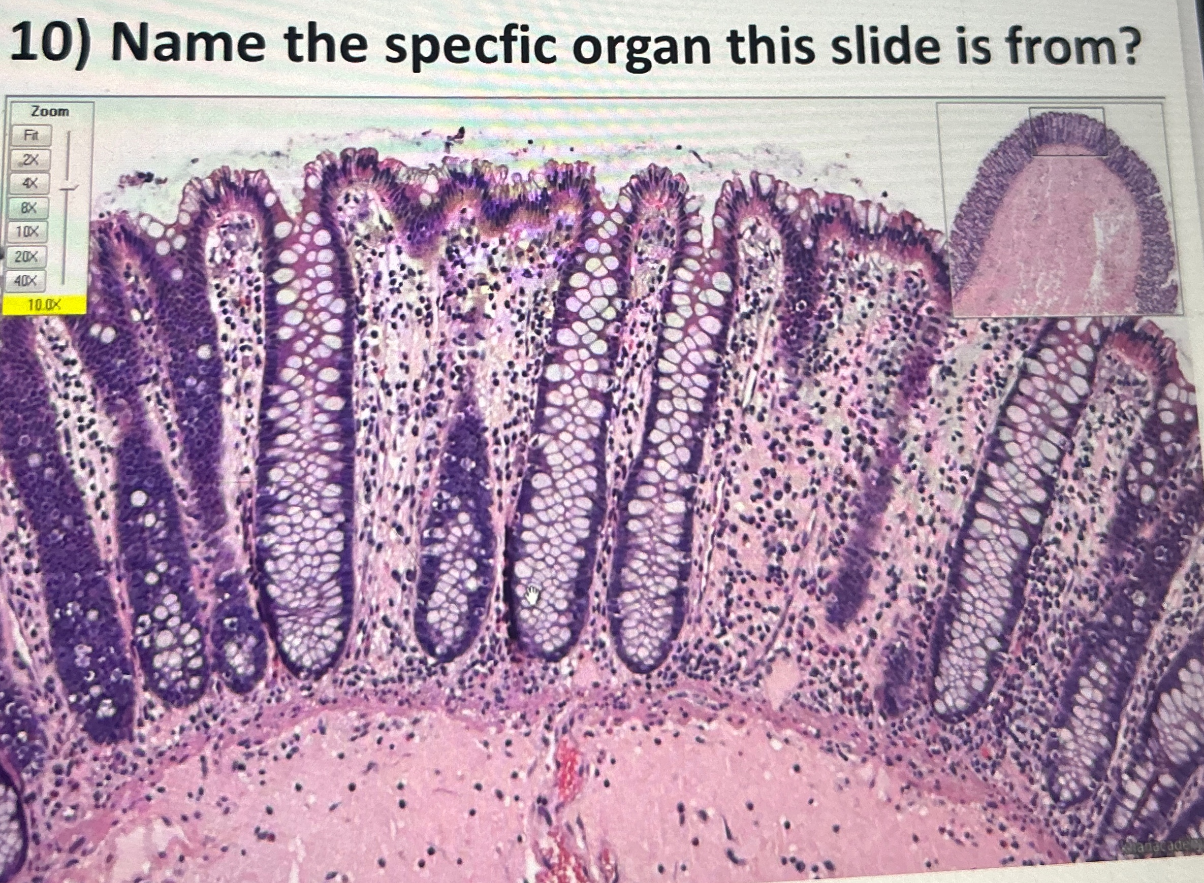 Solved Name the specfic organ this slide is from? | Chegg.com