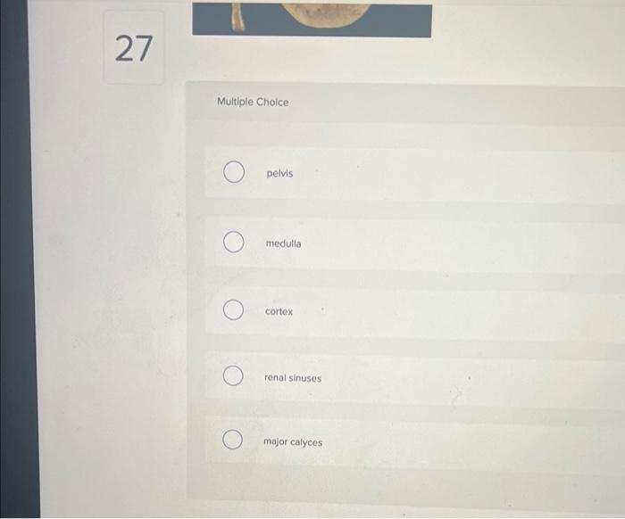 Solved Which structure is highlighted? Multiple Choice | Chegg.com