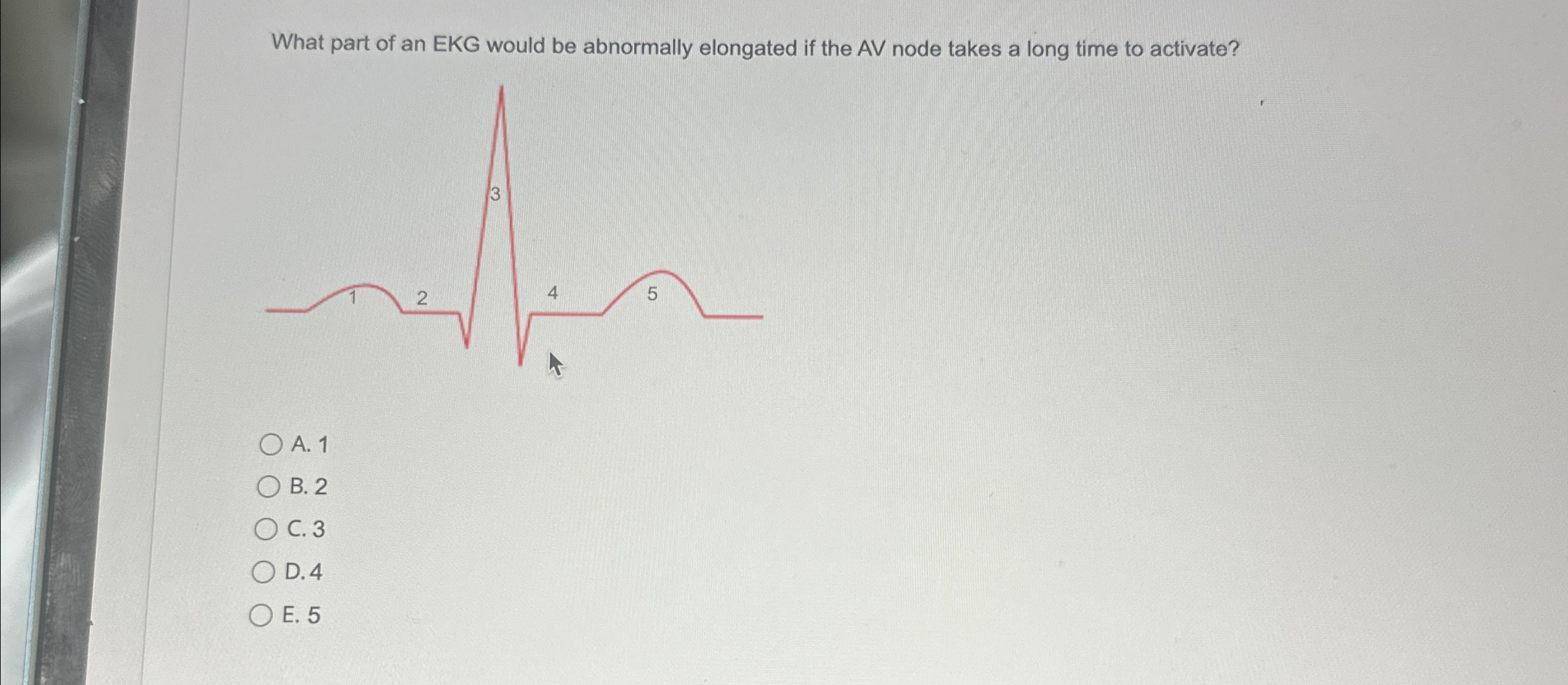 Solved What part of an EKG would be abnormally elongated if | Chegg.com