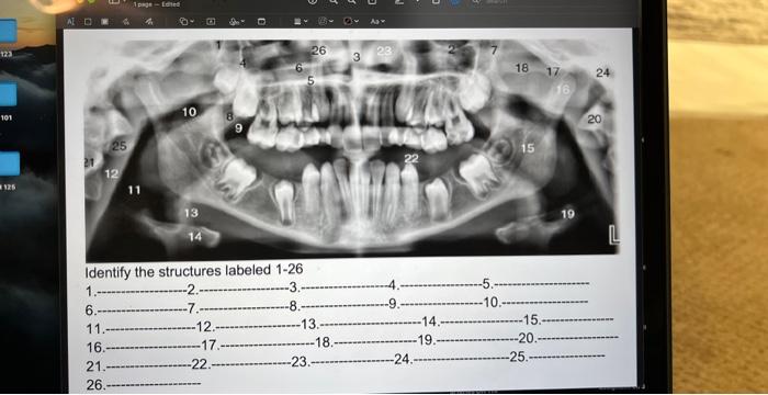 Solved Identifv the structures labeled 1-16.3x | Chegg.com