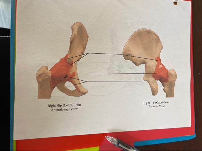 Solved Right Hip (Coxal) Joint Anterolateral View Right Hip | Chegg.com