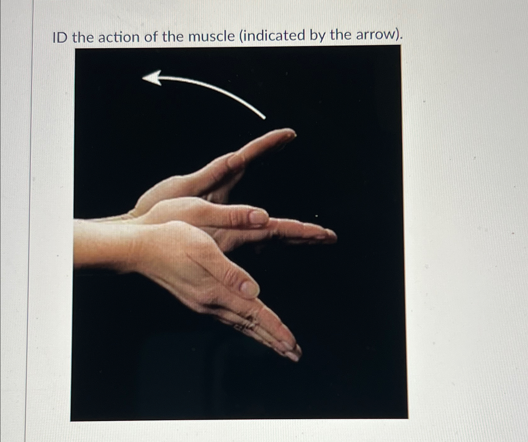 Solved ID the action of the muscle (indicated by the arrow). | Chegg.com