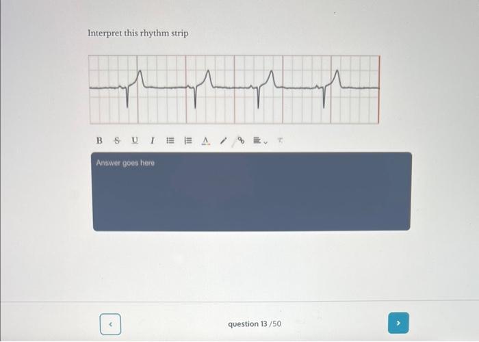 Solved Interpret this rhythm strip Interpret this rhythm | Chegg.com