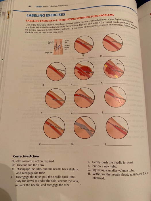 Solved 180 Unit Blood Collection Procedures LABELING | Chegg.com Solved 180 Unit Blood Collection Procedures LABELING | Chegg.com