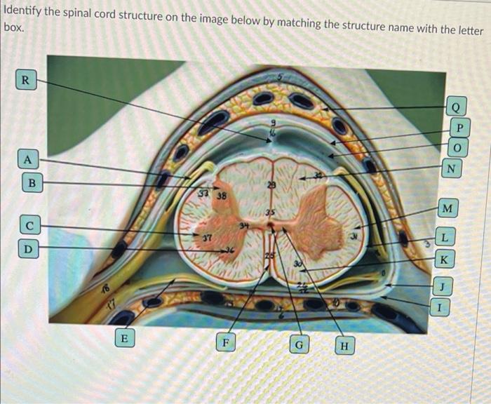 Solved Identify the spinal cord structure on the image below | Chegg.com