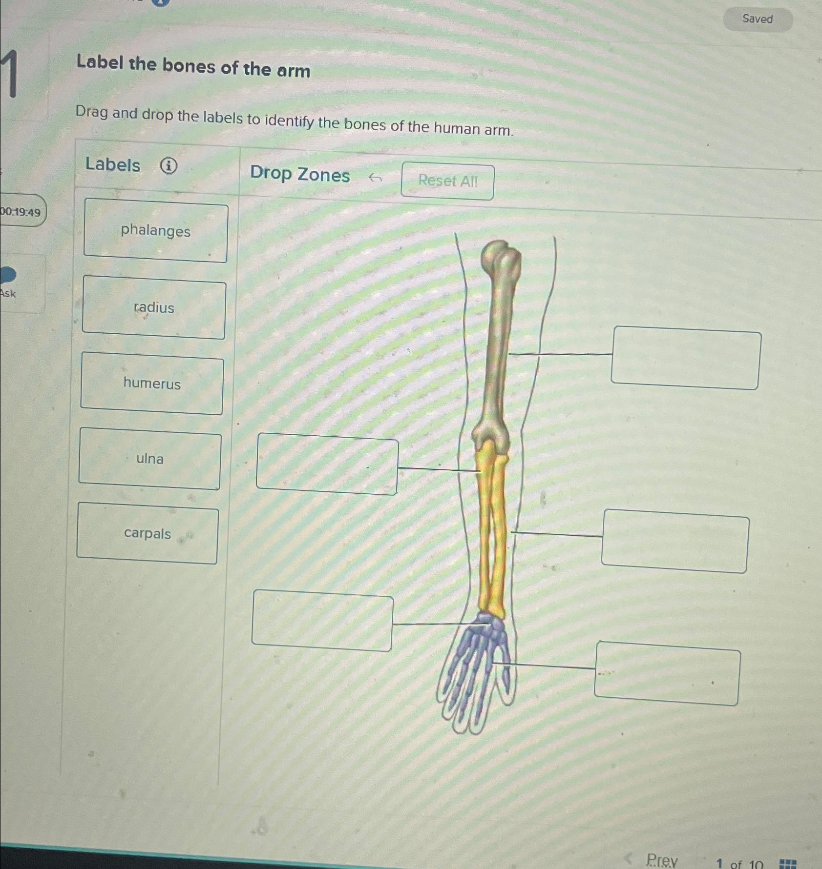 Solved Label the bones of the armDrag and drop the labels to | Chegg.com