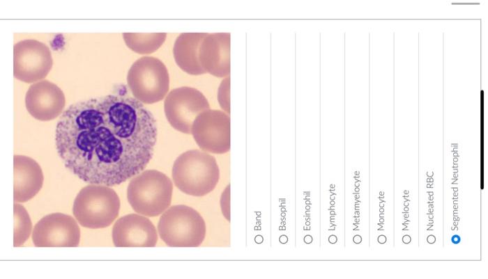 Solved Band Basophil Eosinophil Lymphocyte Monocyte | Chegg.com