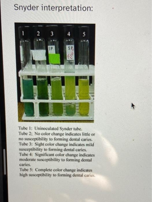 Solved Snyder interpretation: 2 3 3 5 SP se Tube 1: | Chegg.com