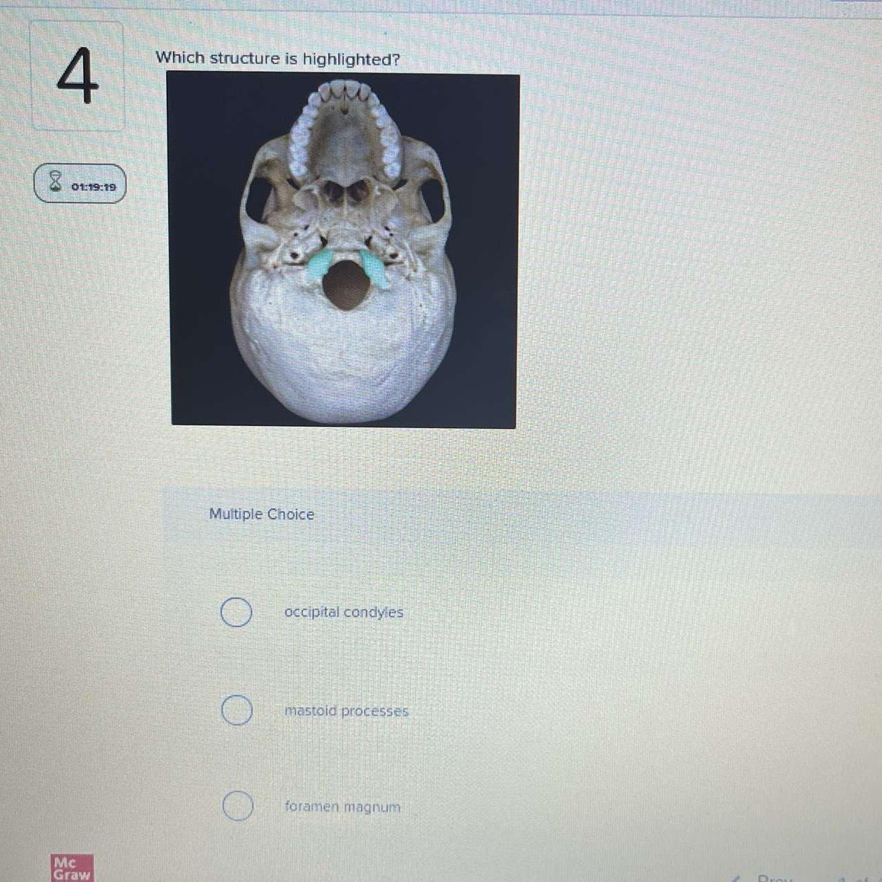 Solved Which structure is highlighted?01:19:19Multiple | Chegg.com