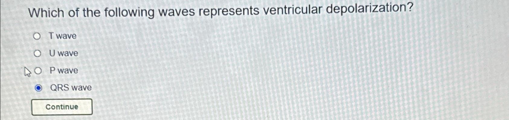 Solved Which of the following waves represents ventricular | Chegg.com