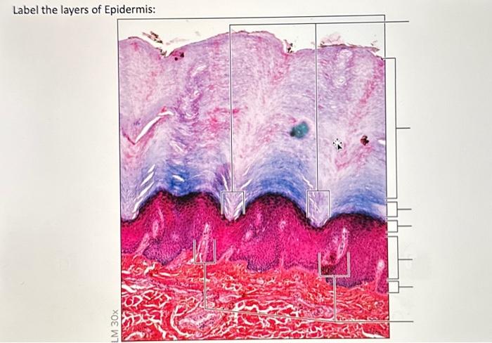 Solved Label the layers of Epidermis: | Chegg.com