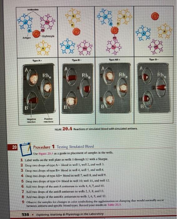 Solved Exercise 20-2 ABO and Rh Blood Groups MATERIALS Well | Chegg.com