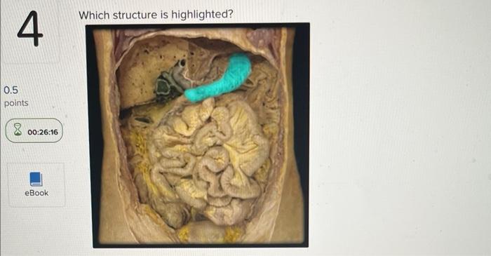 Solved Which structure is hiahlighted? | Chegg.com