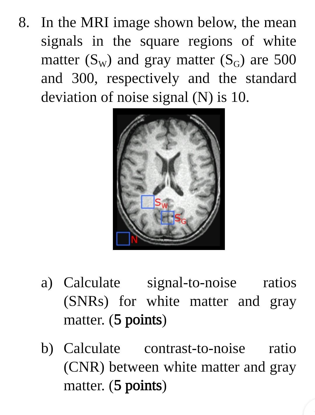 Solved 8. In the MRI image shown below, the mean signals in | Chegg.com
