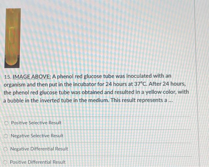 Solved 15. IMAGE ABOVE: A phenol red glucose tube was | Chegg.com