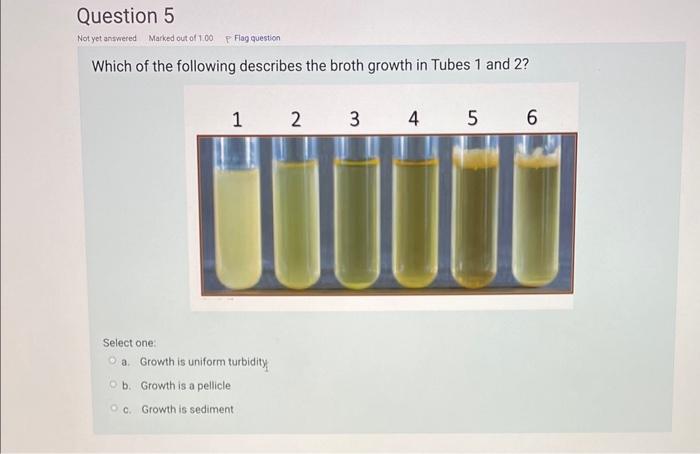 Solved Which of the following describes the broth growth in | Chegg.com
