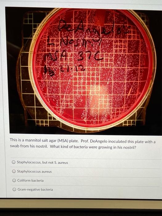 Solved EST PAN This is a mannitol salt agar (MSA) plate. | Chegg.com