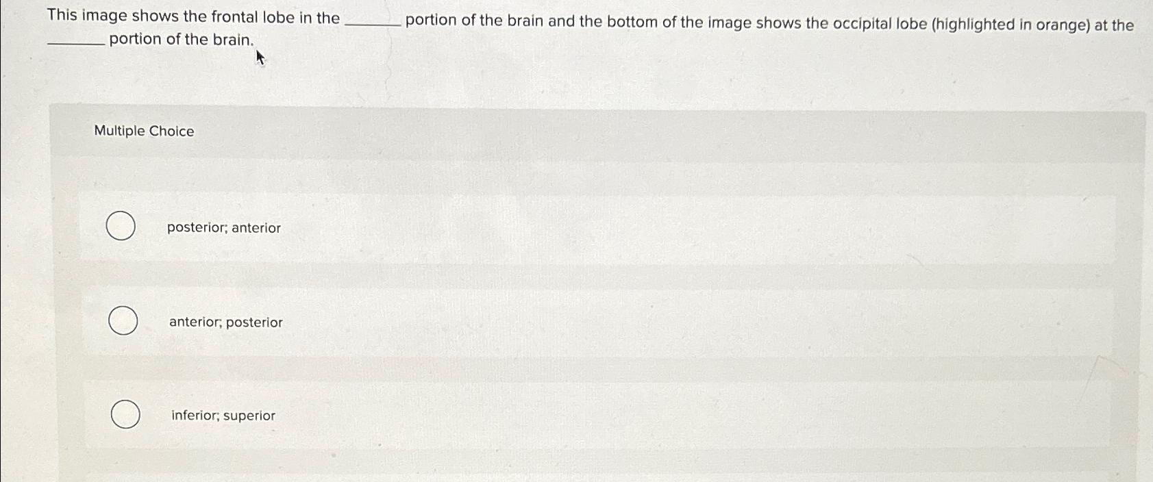 Solved This image shows the frontal lobe in the portion of | Chegg.com