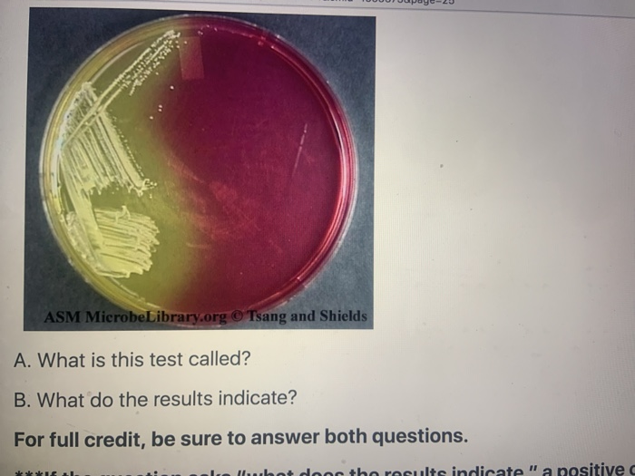 Solved NO ASM MicrobeLibrary.org © Tsang and Shields A. What | Chegg.com