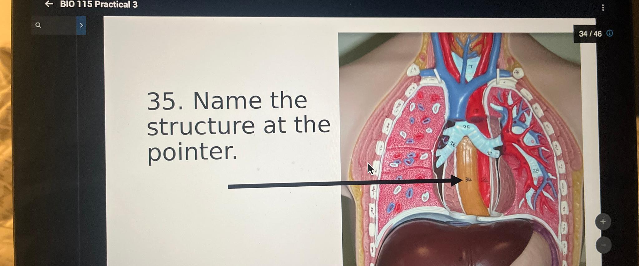 Name the structure at the pointer. | Chegg.com