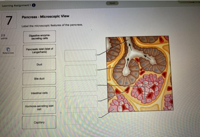Solved Learning Assignment 1 Pancreas - Microscopic View 7 | Chegg.com