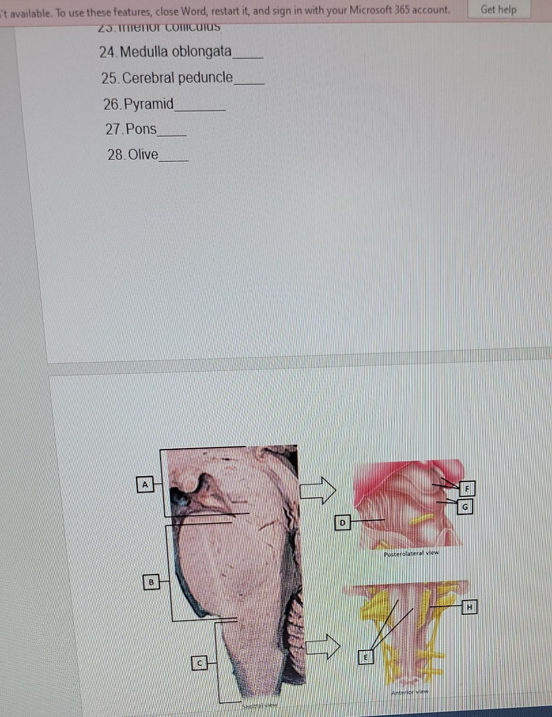 Solved Activity 2: Identifying Major Brain Regions I The | Chegg.com