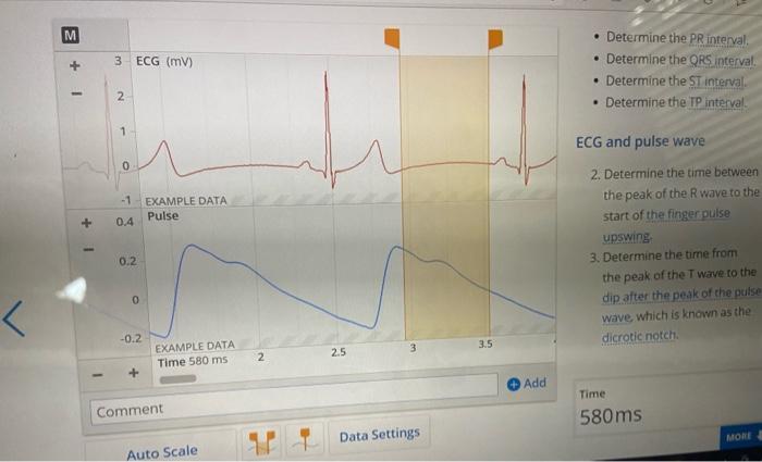 Solved M + 3 ECG (mv) • Determine the PR interval • | Chegg.com