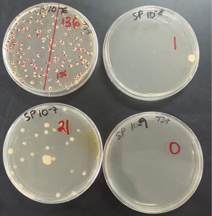 Solved MICROBIOLOGY Record the number of colonies on each | Chegg.com
