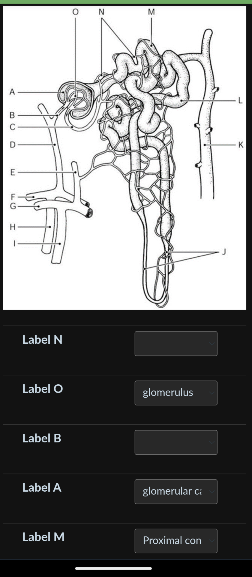Solved Label NLabel OglomerulusLabel BLabel Aglomerular | Chegg.com