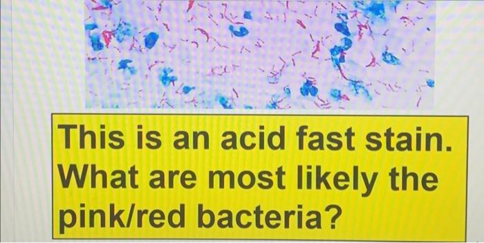 Solved i vi 10 AP This is an acid fast stain. What are most | Chegg.com