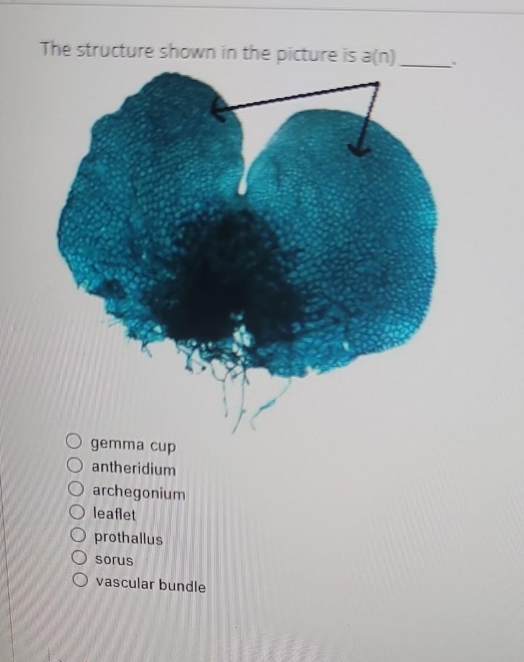 Solved The structure shown in the picture is aind gemma cup | Chegg.com