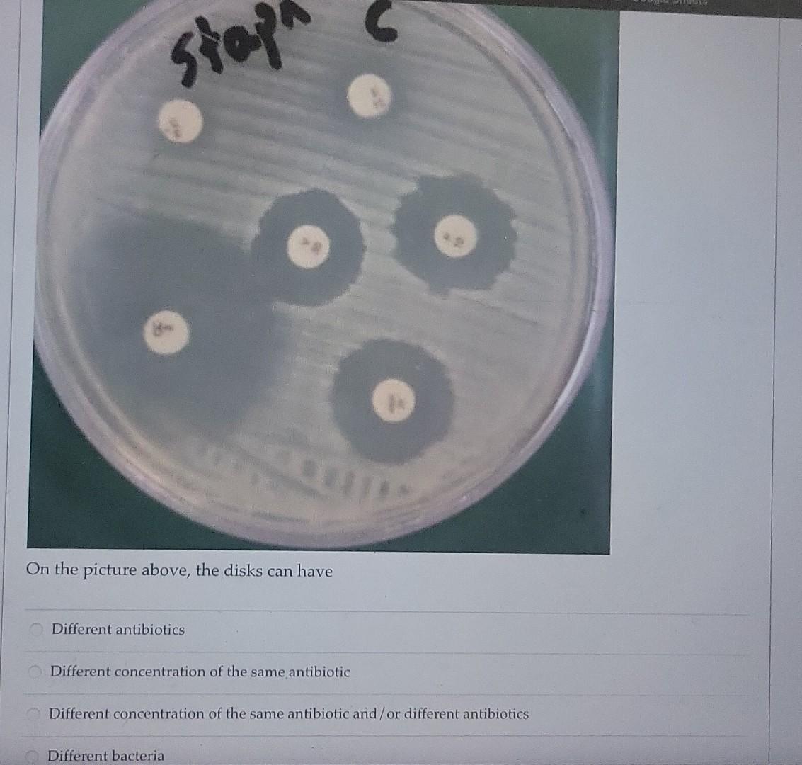 Solved The plate on the picture is inoculated using plating | Chegg.com