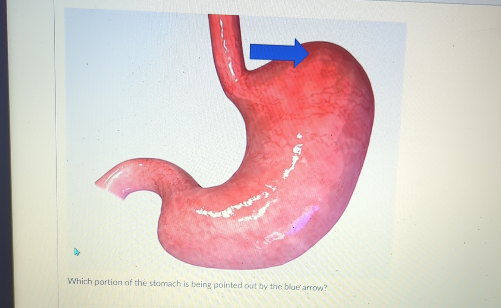 Solved Which portion of the stomach is being pointed out by | Chegg.com