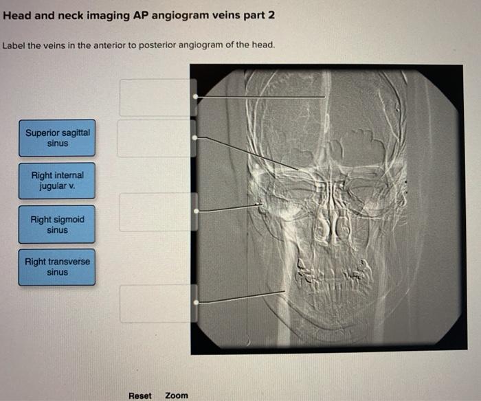 Solved Head and neck imaging AP angiogram veins part 2 Label | Chegg.com