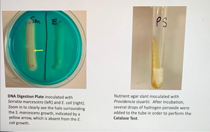 Name: Exercise 9 Results Starch Plate Observations | Chegg.com