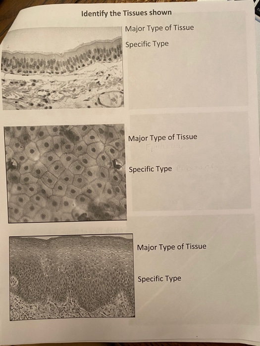 Solved Identify the Tissues shown Major Type of Tissue | Chegg.com