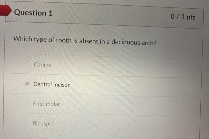 Solved Question 1 0/1 pts Which type of tooth is absent in a | Chegg.com