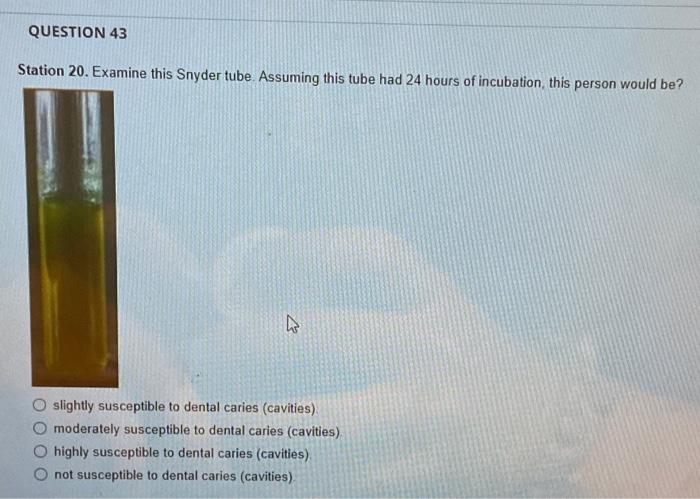 Solved QUESTION 43 Station 20. Examine this Snyder tube. | Chegg.com
