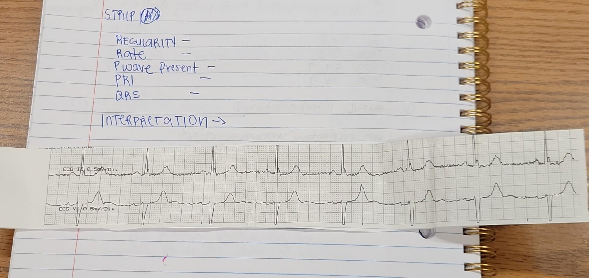 could you please help me with my homework. EKG | Chegg.com