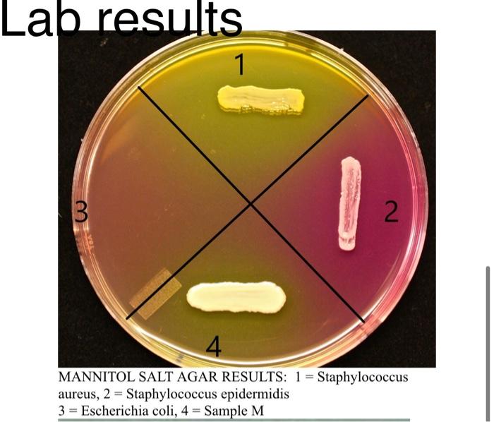 Solved Mannitol Salt Agar Your Results and Observations Draw | Chegg.com